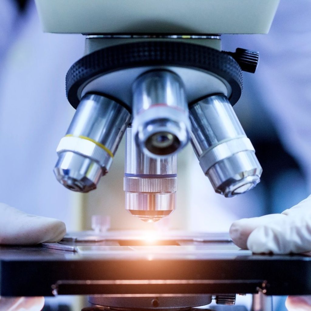 Microsurgical Ligation Of Varicocele Fertility Solutions